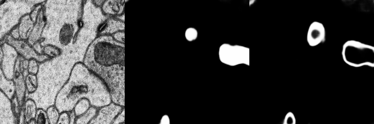 BioImage.IO - Model Zoo